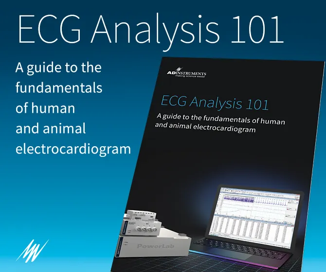 Ecg Software Ekg Ecg Data Analysis App Ecg Reader Adi